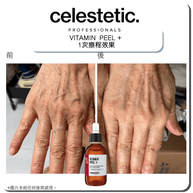 Celestetic. 眼部緊緻提升及手部煥膚療程 – Derm-Mart