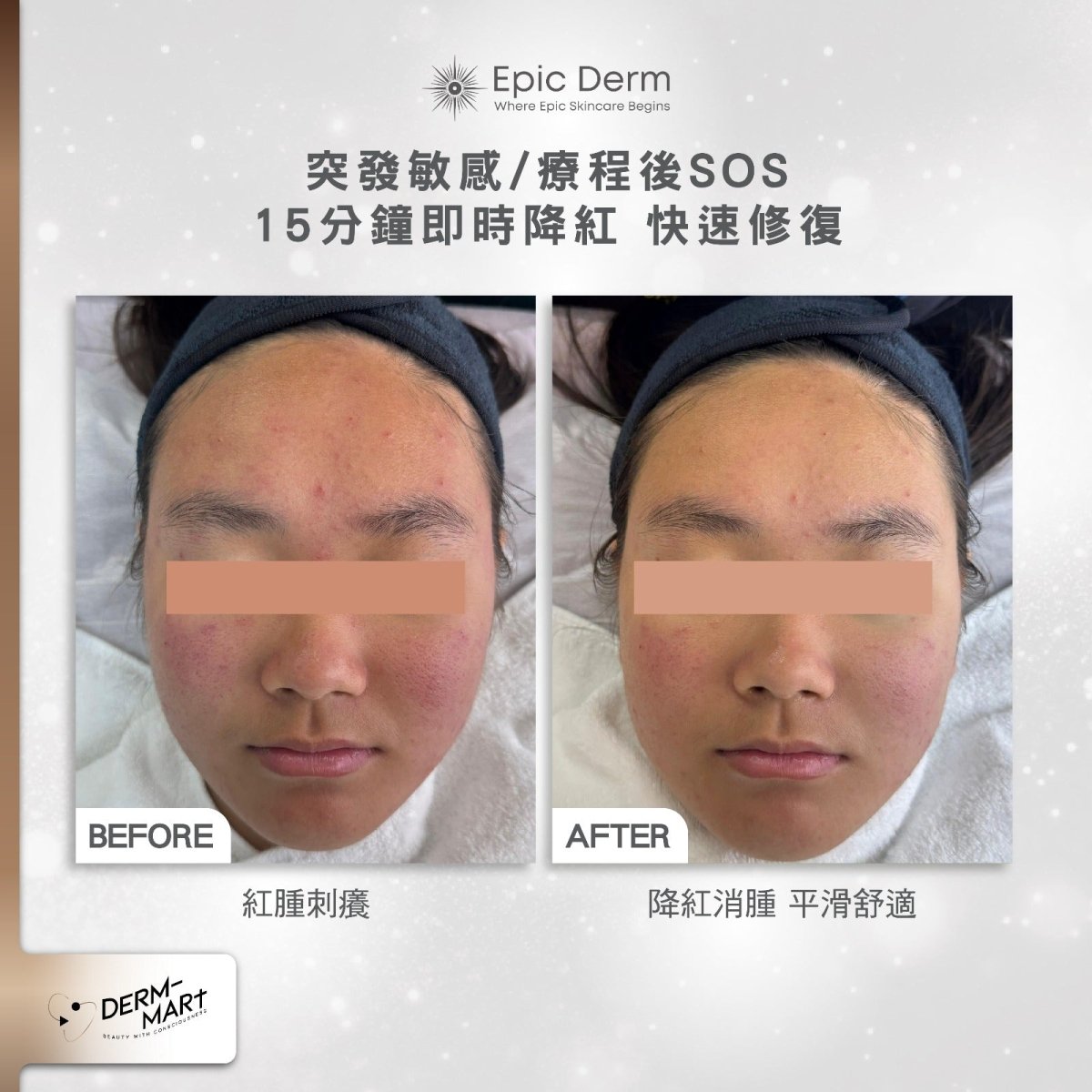 醫學護膚品牌 | 醫學美容產品 | Clean Beauty 香港 – Derm-Mart